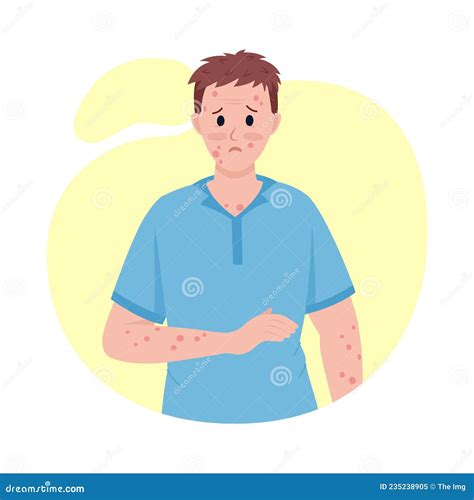Man With Skin Rash Semi Flat Color Vector Character Stock Vector