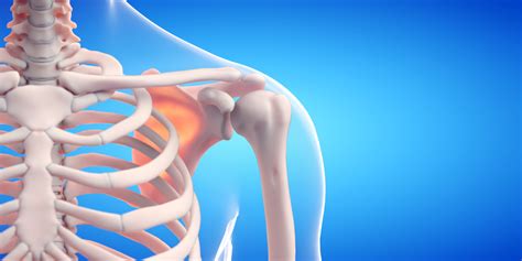 Acromioclavicular Joint Injection Cortisone Injections