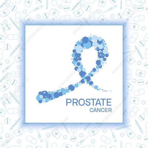 Prostate Cancer Illustration Stock Image F0323593 Science Photo
