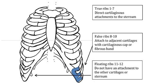 Floating Rib Syndrome Mayo Clinic