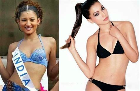 Gauhar Khan Plastic Surgery