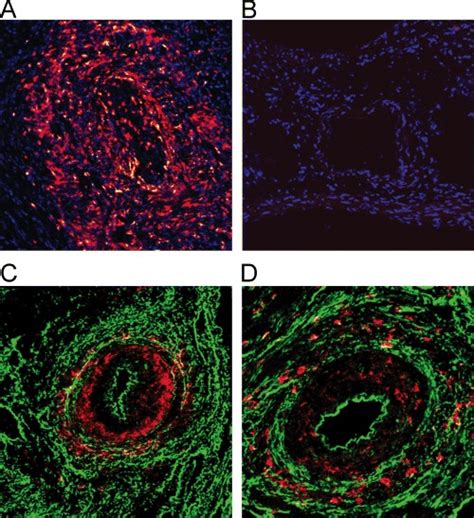 Infiltration Of B6 And Act Mova Grafts By Cd11b Cells Cd11bgr 1