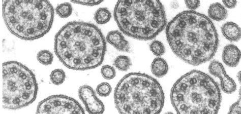 Cilia Electron Microscopes