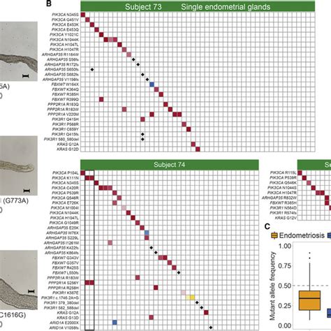 Diverse Mutations In Single Endometrial Glands A Microscopic Images
