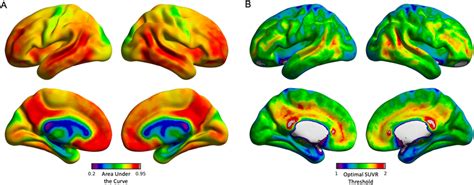 Area Under The Curve Auc And Optimal Amyloid Beta Aβ Thresholds