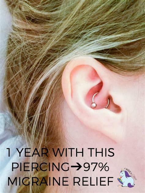 Migraine Piercing 1 Year Results Natural Headache Remedies