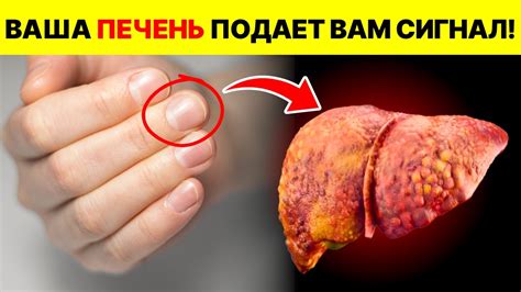⚠️ 12 ПРИЗНАКОВ ЗАБОЛЕВАНИЯ ПЕЧЕНИ КОТОРЫЕ МОЖНО УВИДЕТЬ ВРАЧ