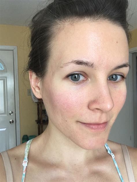 How To Conceal Acne Scars With Makeup Atelier Yuwa Ciao Jp