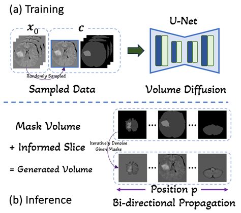 3d Mri Synthesis With Slice Based Latent Diffusion Models Improving
