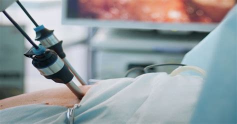 Cpt Code For Laparoscopic Cholecystectomy