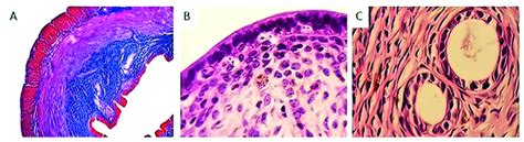 Representative Photomicrographs Of The Uterus Of The Animals From Group