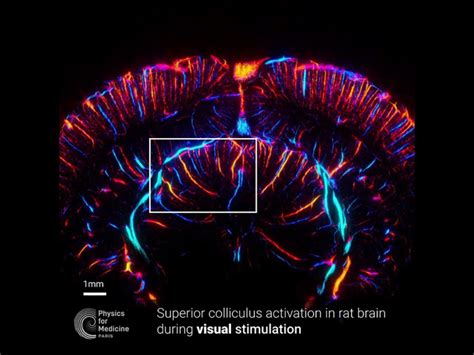 Functional Ultrasound Microscopy Visualizes Whole Brain Neuronal Activity At The Micro Level