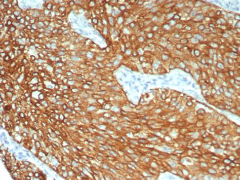 Cytokeratin 6krt6 Pan Abc Basal Cell Marker Recombinant