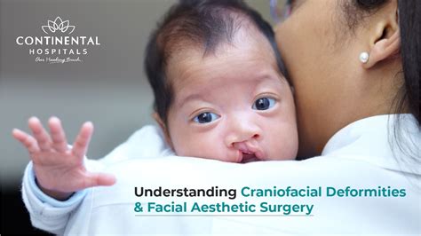Craniofacial Deformities And Facial Aesthetic Surgery