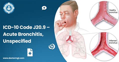 Icd 10 Code J20 9 Acute Bronchitis Unspecified