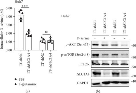 Slc1a4 Promotes Malignant Transformation Of Hepatocellular Carcinoma By