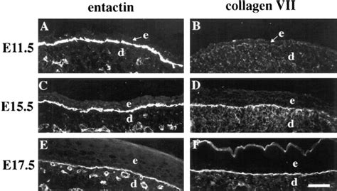 Distributions Of Entactin And Type Vii Collagen In The Developing Skin