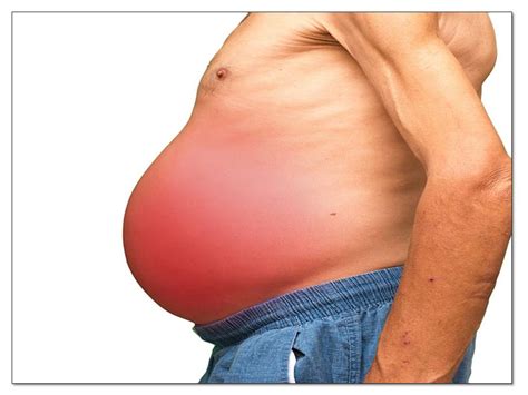 Natural Cure For Ascites