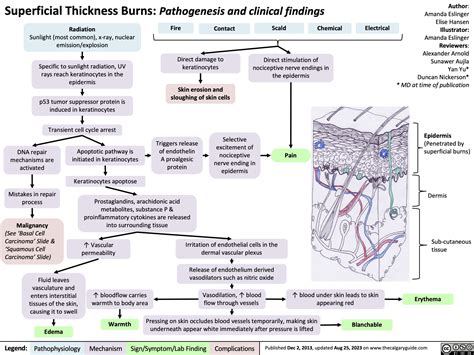 Superficial Thickness Burns Calgary Guide