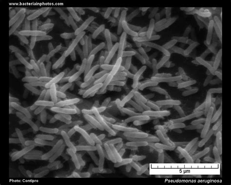 Pseudomonas Aeruginosa Biofilm