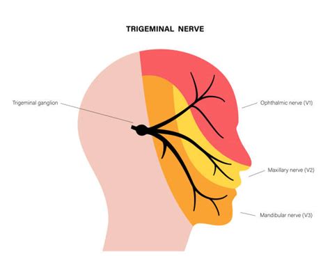 Trigeminal Neuralgia Neurology And Sleep Centre