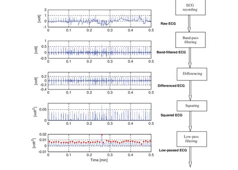 The Four Stages Of The Qrs Detection Algorithm Along With Corresponding
