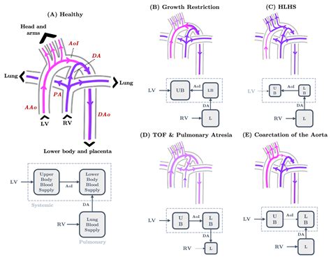 Recasting Current Knowledge Of Human Fetal Circulation The Importance Of Computational Models