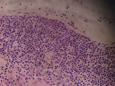 Veterinary Medicine Sheep Thymus 5 Part Of The Cortex With T Cells