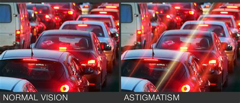 Astigmatism Vision Astigmatism Treatment Birmingham Laser Eye Surgery