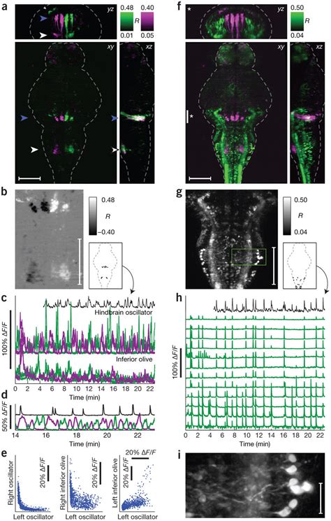 Whole Brain Cellular Level Activity Mapping In A Second It Is Now