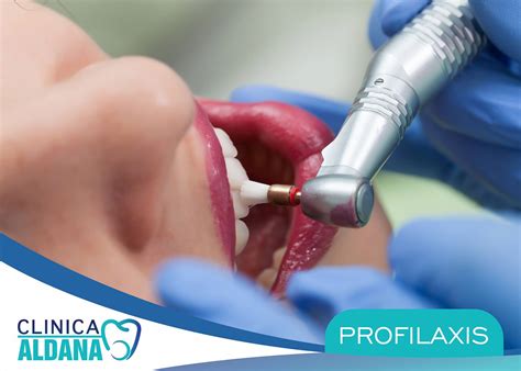 Clínica Dental Aldana Home Facebook