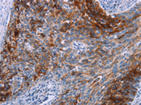 兔抗krt14多克隆抗体anti Krt14 Rabbit Polyclonal Antibody 生命科学产品与技术服务 生工生物工程
