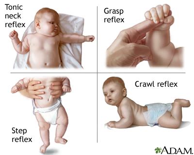 Infantile Reflexes Medlineplus Medical Encyclopedia Image