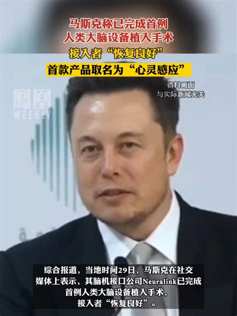 马斯克称已完成首例人类大脑设备植入手术 马斯克 尽知天下事凤凰网视频凤凰网