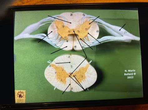 Dorsal Root Diagram Quizlet