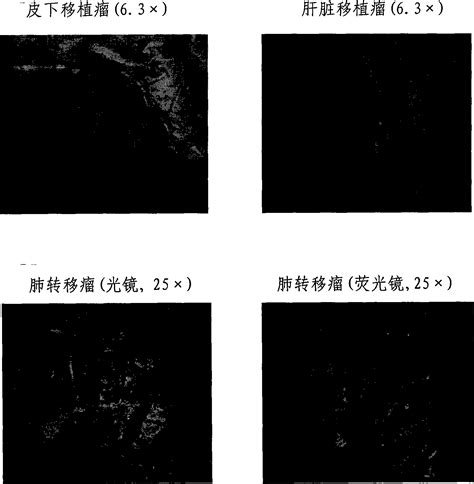 Installation Method Of Fluorescent Visual High Transfer Human Liver