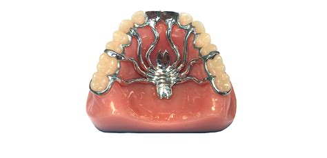 Mcdowell And Service Cobalt Chrome Frameworks Mcdowell