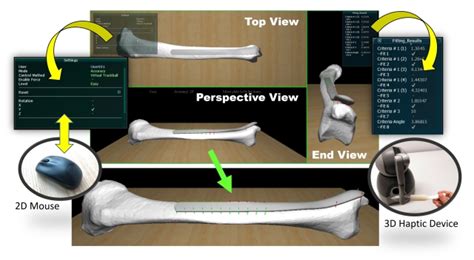 Virtual Haptic System For Intuitive Planning Of Bone Fixation Plate Placement Thomas K S Choi