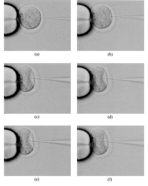 Figure 2 From Development Of A Vibratory Microinjection Method Semantic Scholar