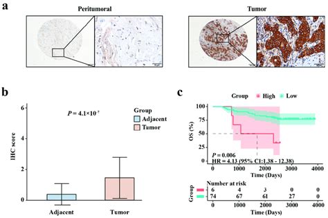 Ihc Staining Validating The Expression Level And Prognostic Value Of