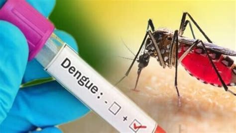 Dengue Virus