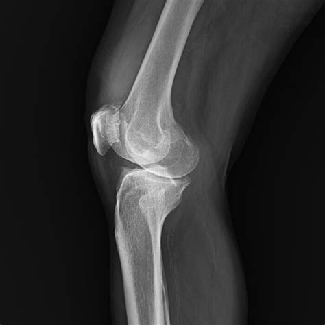 Flat Panel Detectors Prognosys Medical Systems