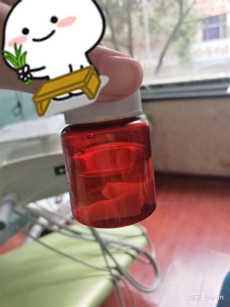 分享拔智齿的亲身经历 知乎