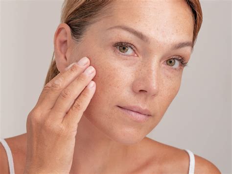 4 Principais Causas Das Manchas Na Pele E Como Atenuá Las Skin Boutique