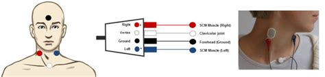 Eclipse Cvemp Testing Interacoustics