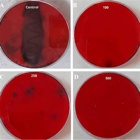 Anti Biofilm Activity Of Agnp Against Staphylococcus Aureus Using