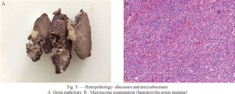 Pdf How To Diagnose Splenic Abscesses Semantic Scholar