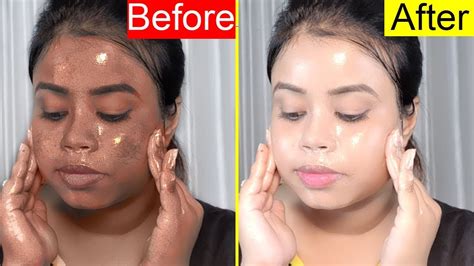 Really Surprising In Just 1 Day Get Milky Whiten Skin Clear Glowing