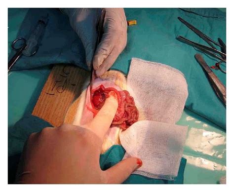 A And B Traditional Partial Nephrectomy Model With Suture On Download Scientific Diagram