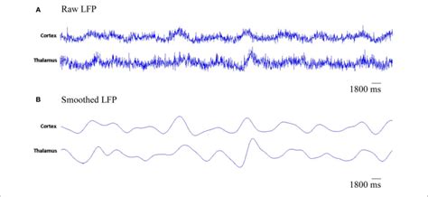 the simulated lfp of thalamic and cortical networks a raw lfp